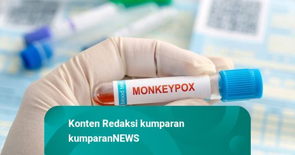 Ini Beda Gejala Cacar Monyet dan Cacar Air | kumparan.com